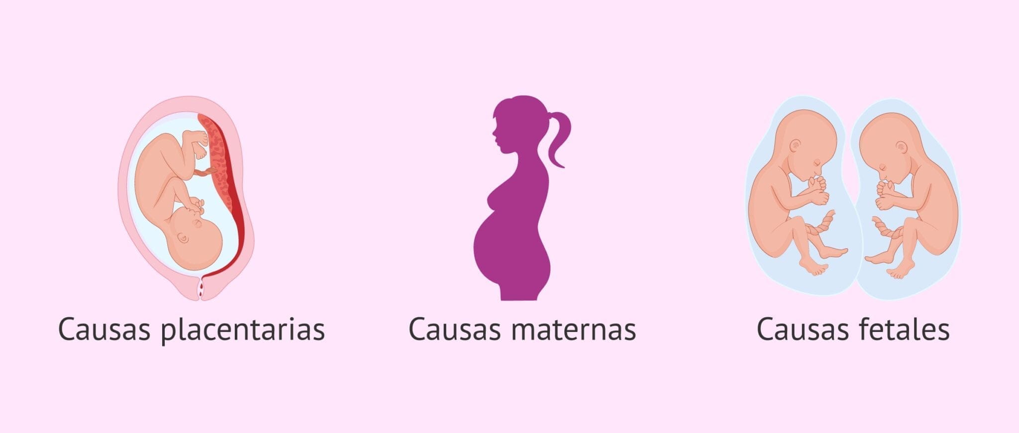 ¿Por qué se produce el crecimiento intrauterino retardado o CIR?