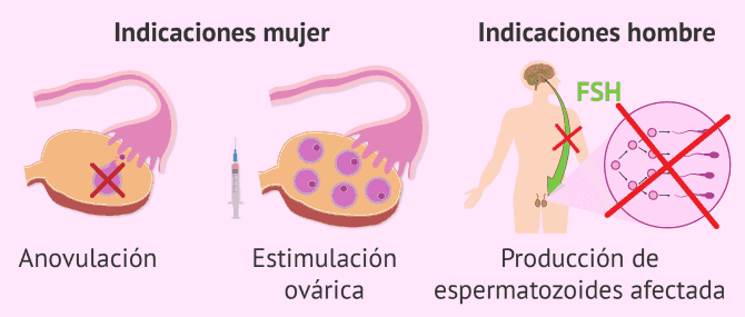 Indicaciones y contraindicaciones de Puregon para la fertilidad