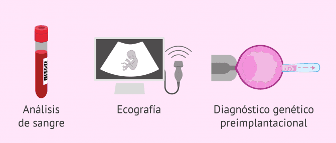 La amniocentesis: ¿cuáles son sus indicaciones y posibles riesgos?