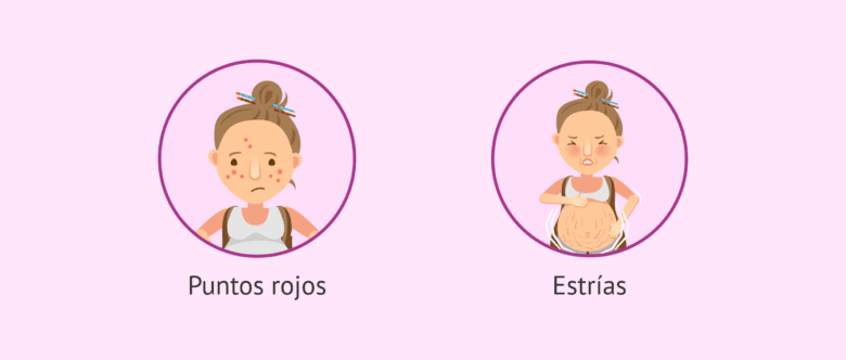¿Cómo es la semana 22 de embarazo? ¿Qué cambios ocurren?