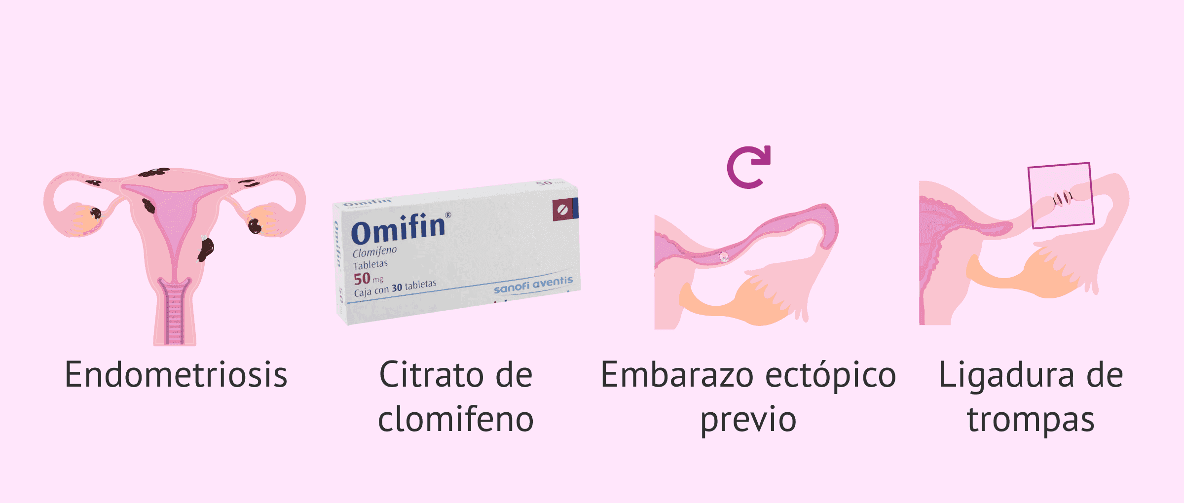 ¿Cuáles son las causas y consecuencias del embarazo ectópico?