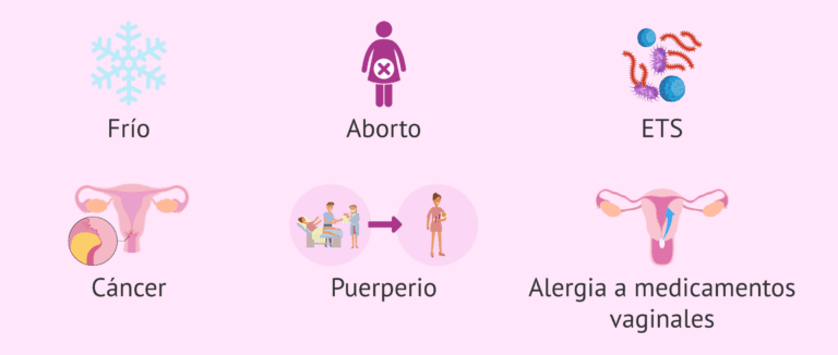 La Inflamación Del Ovario Causas Y Síntomas Principales 6461