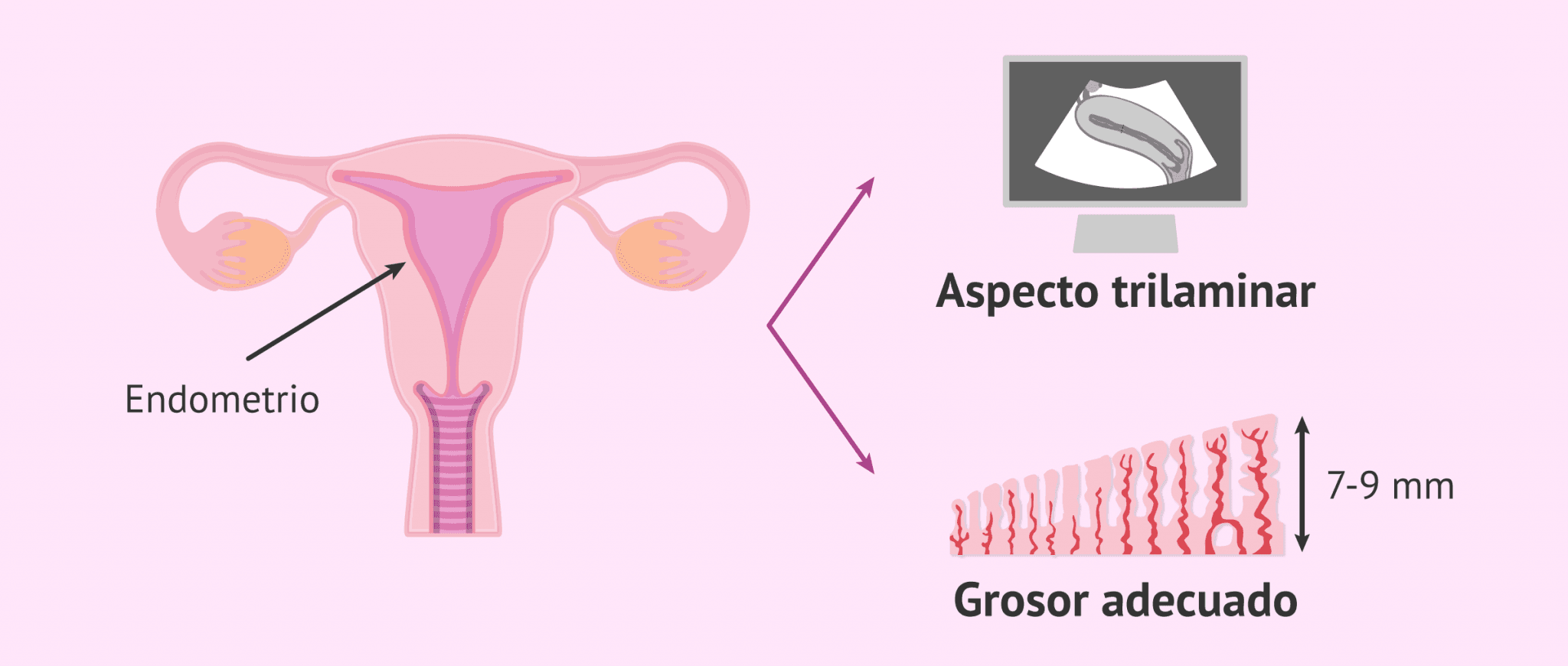 Por Qué Es Importante El Endometrio En Reproducción Asistida