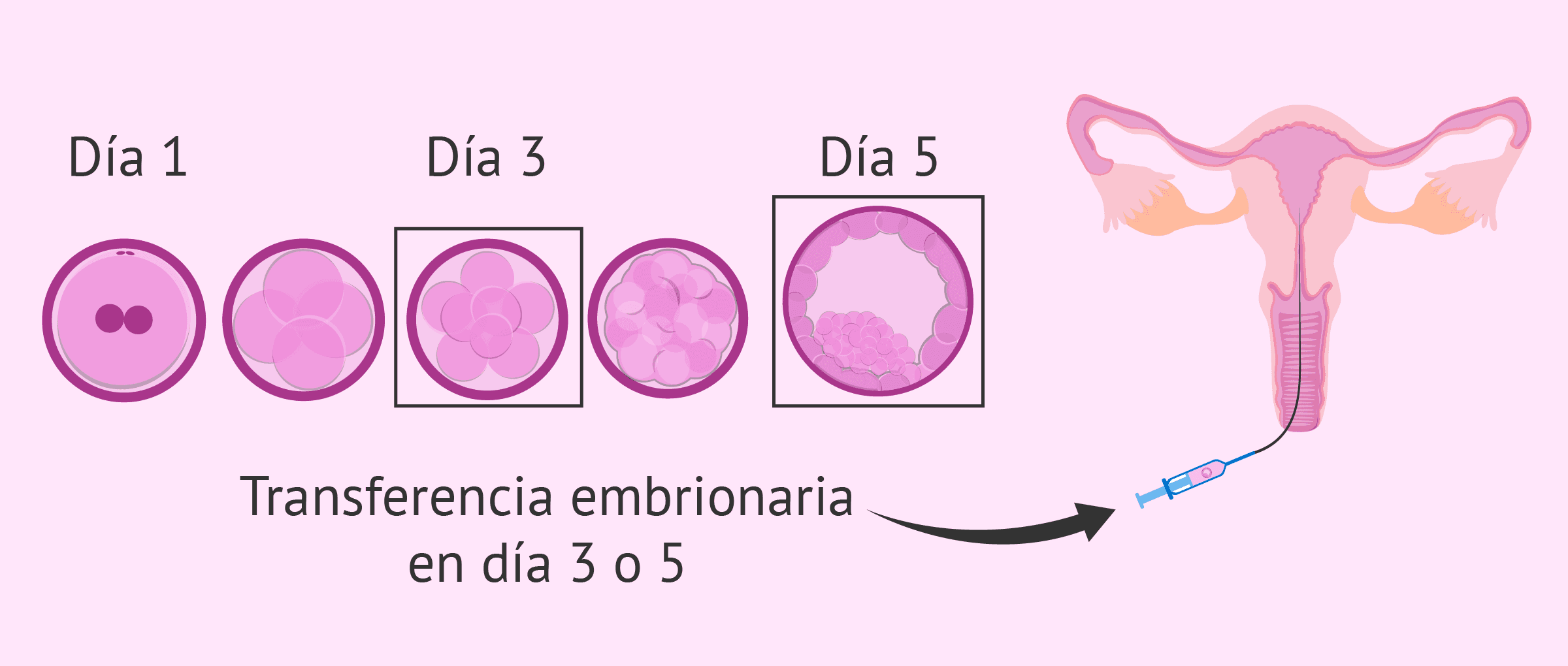 Transferencia embrionaria: ¿Cuántos embriones hay que transferir?
