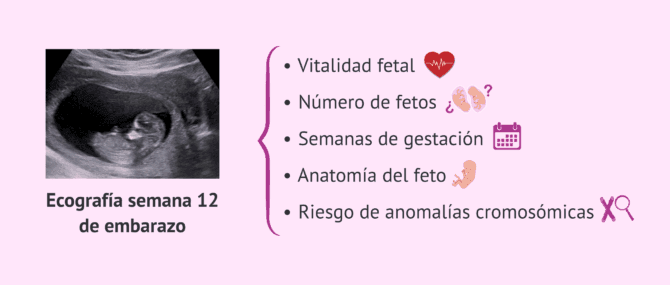 Semana 12 de embarazo: el primer trimestre llega a su fin