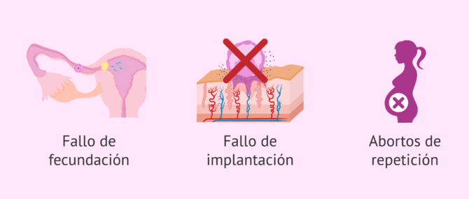 ¿Qué son los miomas uterinos y qué tipos hay? Diagnóstico y tratamiento