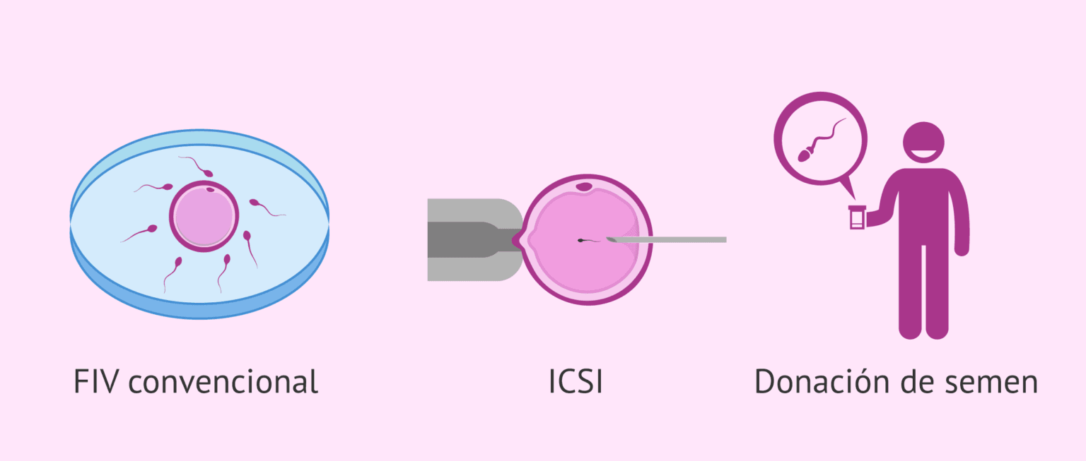 ¿Qué es la astenozoospermia? - Definición, causas y tratamiento