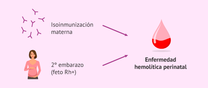 Isoinmunización materna por incompatibilidad Rh, ¿qué riesgos hay?