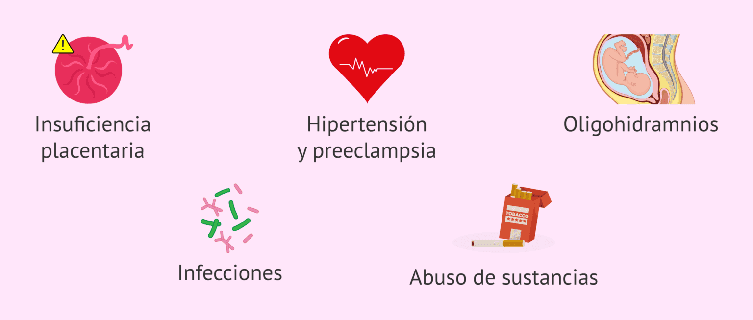 Factores de riesgo para el líquido amniótico teñido de meconio
