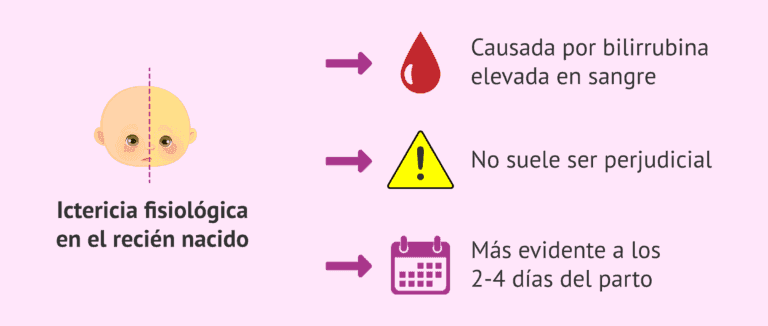 ¿Qué es la ictericia en el bebé?