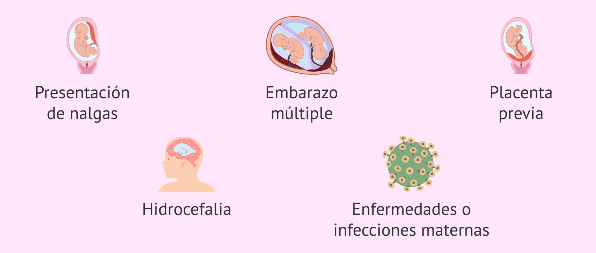 Cesárea programada, ¿cuándo está indicada y cuáles son los riesgos?