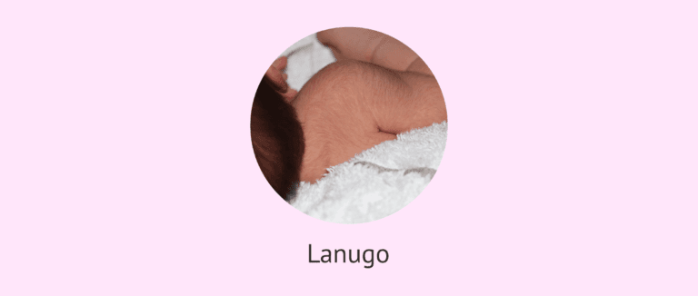 Lanugo, Qué Es Y Para Qué Sirve El Vello En La Piel Del Recién Nacido ...