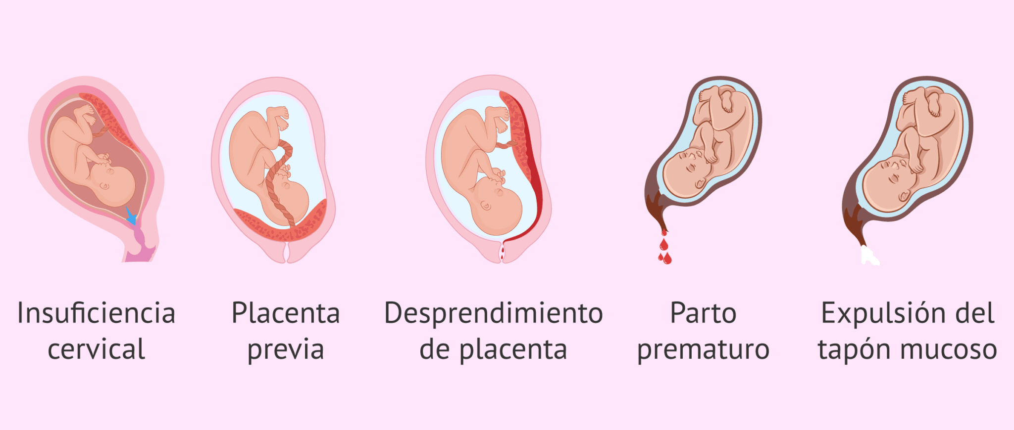 ¿Es normal el sangrado en el embarazo? ¿Cuáles son las causas?