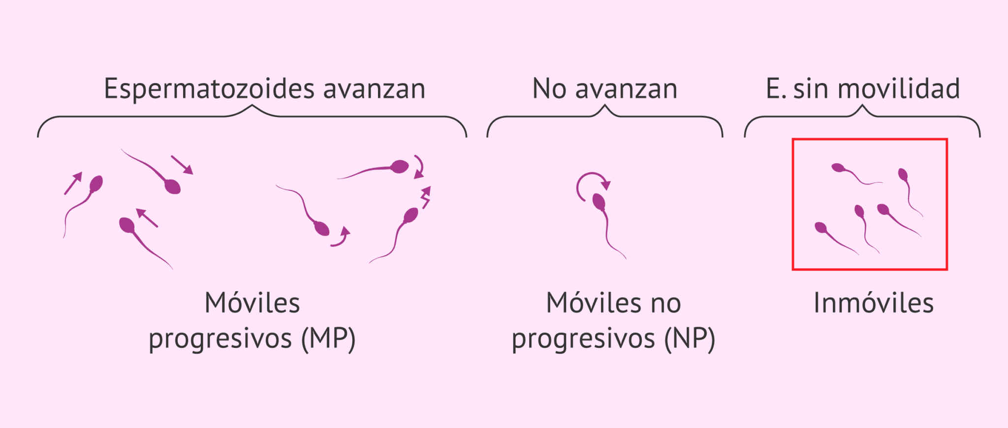 ¿Qué ocurre si la movilidad espermática progresiva es superior a 32% ...