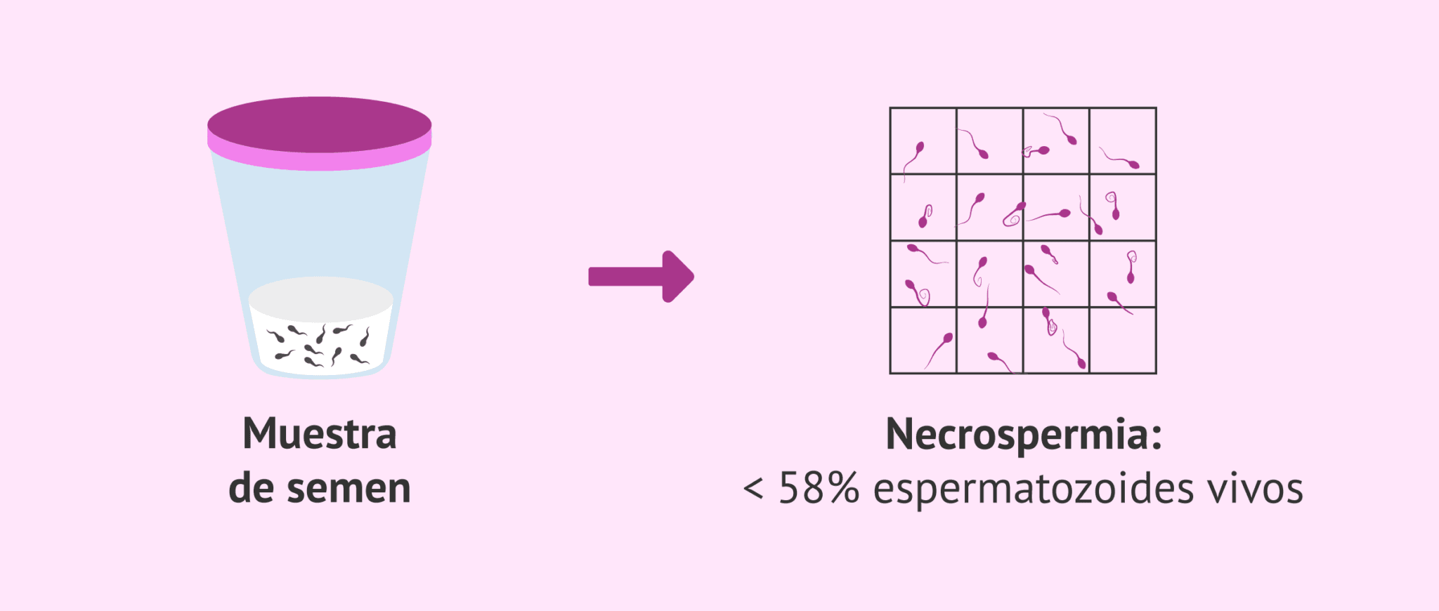 Espermatozoides con necrospermia: definición, causas y tratamiento