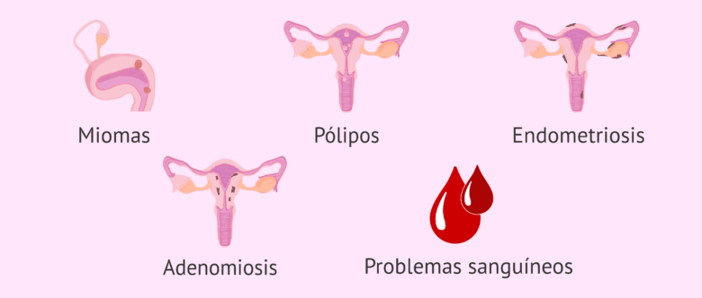 ¿Por qué salen coágulos de sangre en la menstruación?