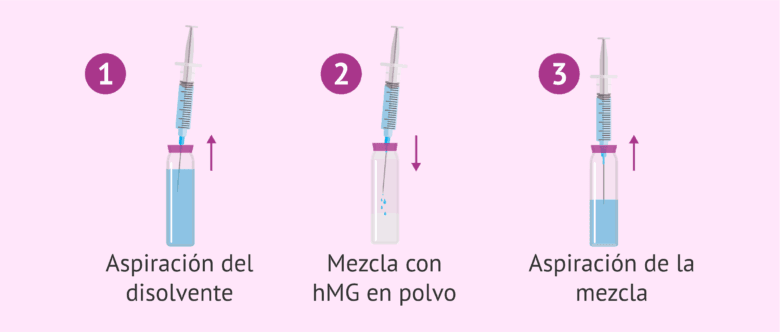 HMG-lepori 75 UI: administración y precio