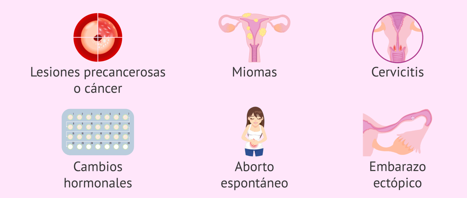 ¿Qué es el sangrado intermenstrual y por qué puede estar producido?