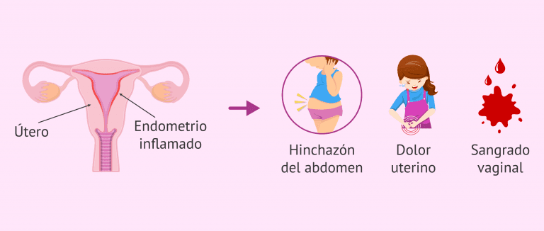 ¿Qué es la enfermedad inflamatoria pélvica (EIP)? Causas y tratamientos