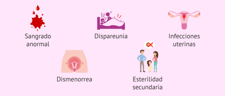 ¿Qué es el istmocele uterino? ¿Por qué causa infertilidad secundaria?