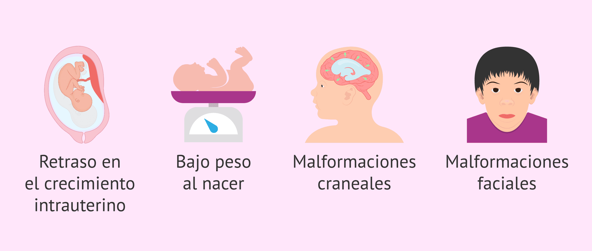 Algunos síntomas del Síndrome de Alcoholismo Fetal (SAF)