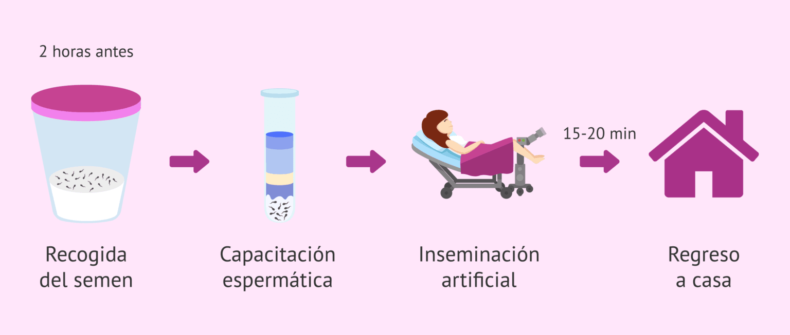 ¿Qué duración tiene la inseminación artificial y qué tiempo debo ...