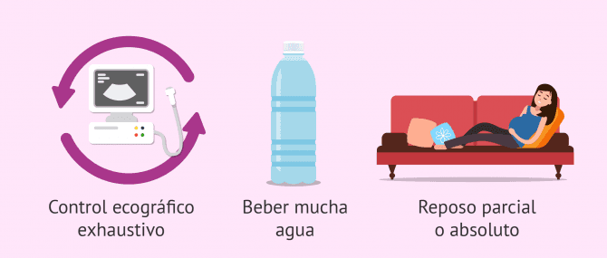 Oligohidramnios: causas, diagnóstico y tratamiento en el embarazo