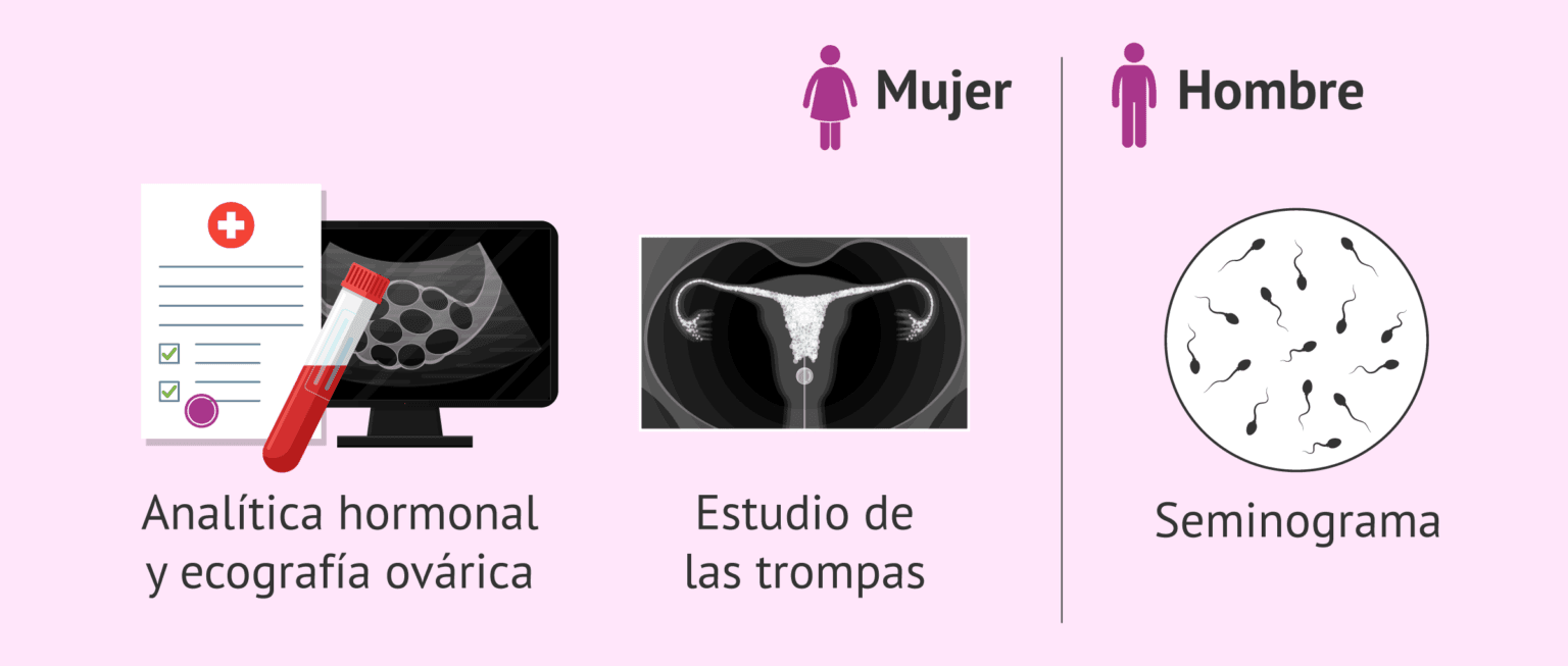 ¿Es reversible la ligadura de las trompas de Falopio?