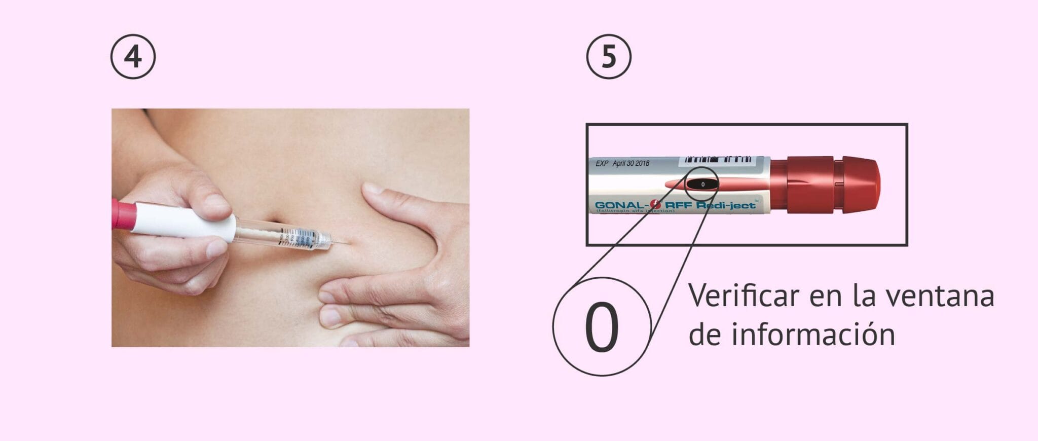 Gonal-f pen: dosis de 300, 450 y 900 – ¿Cómo se aplica?