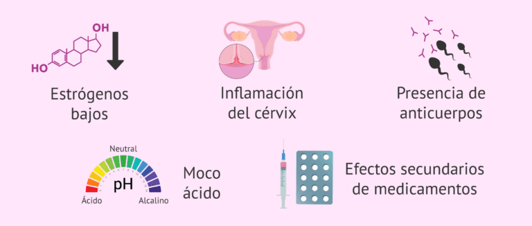 Principales alteraciones del moco del cuello uterino (moco cervical)