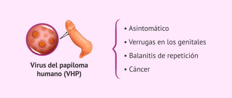 Síntomas de la infección por VPH en hombres