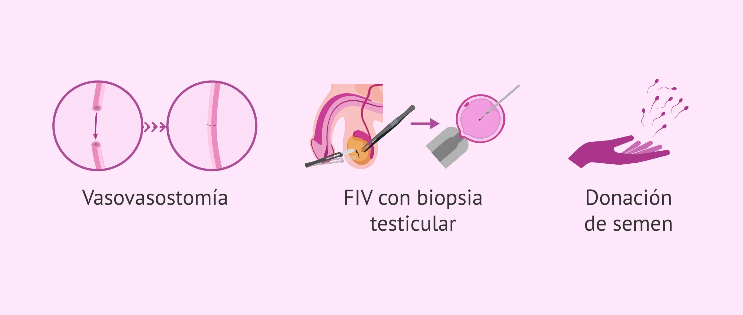 Cicatriz De Vasectomia