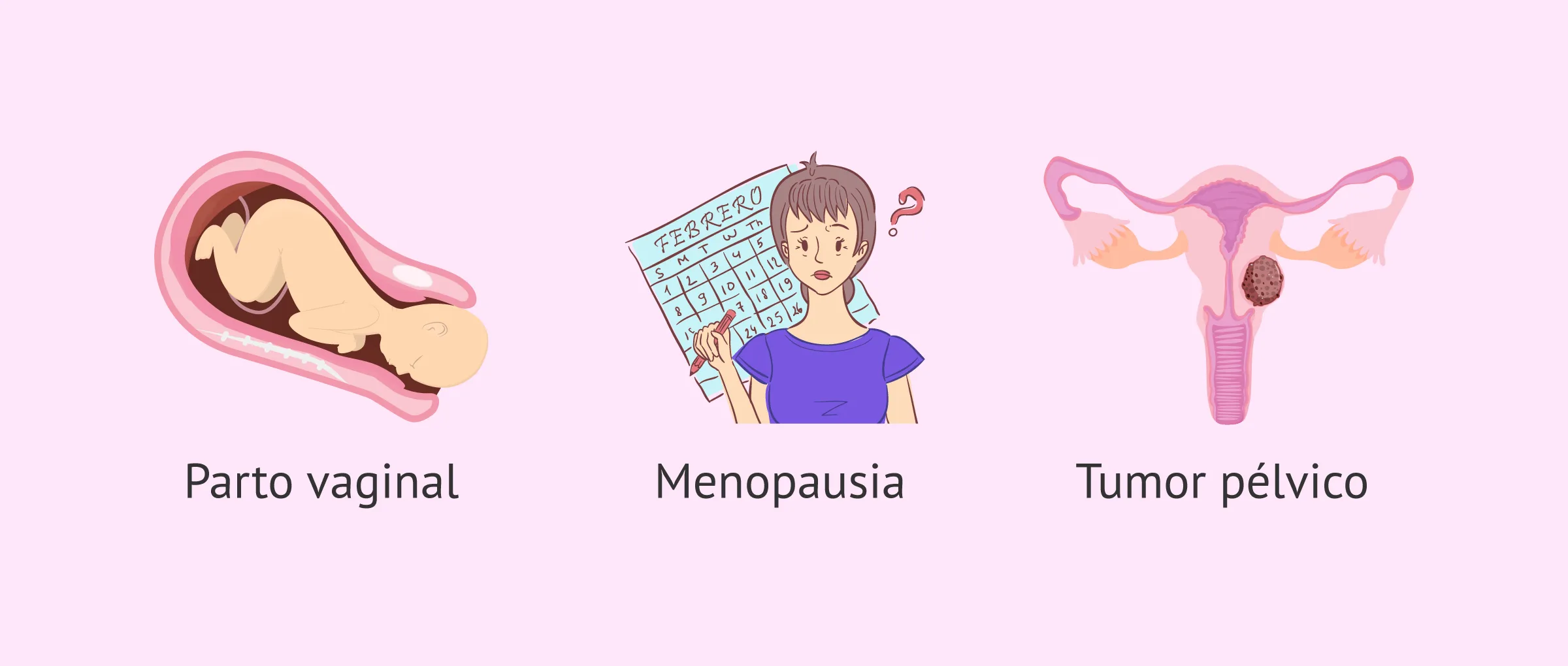 Prolapso Uterino Humano