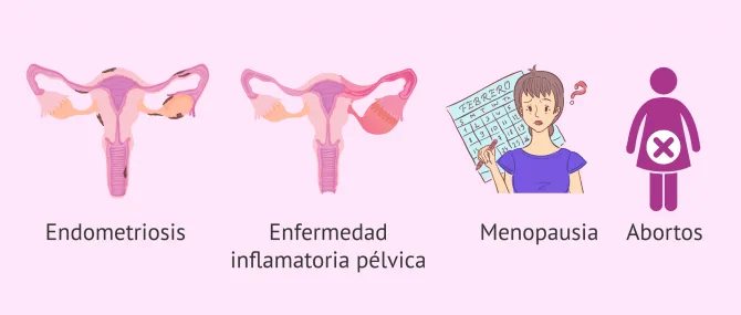 Diagrama De Utero Invertido Changing The Way You Learn | Mind Map