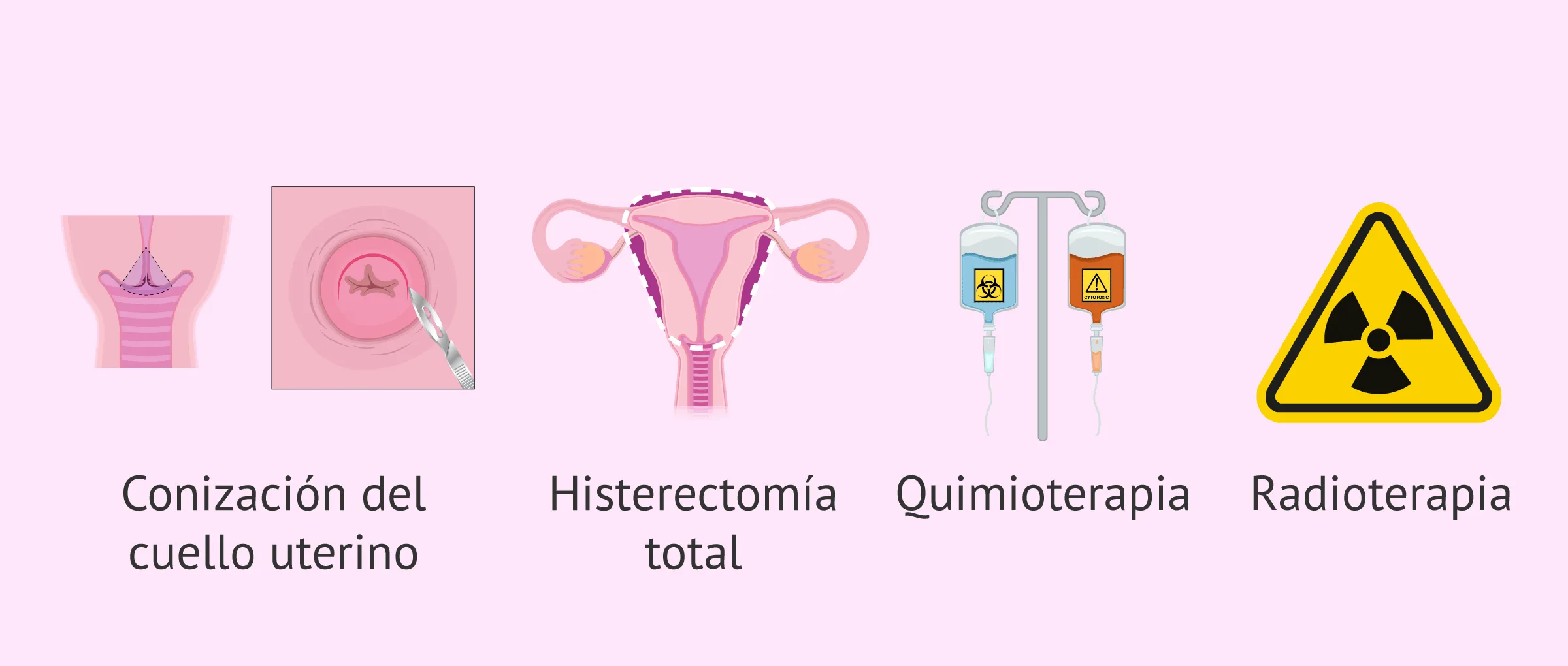 Sintomas Del Cancer Cervicouterino