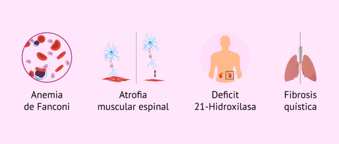 ¿Qué enfermedades genéticas o cromosómicas detecta el PGT?