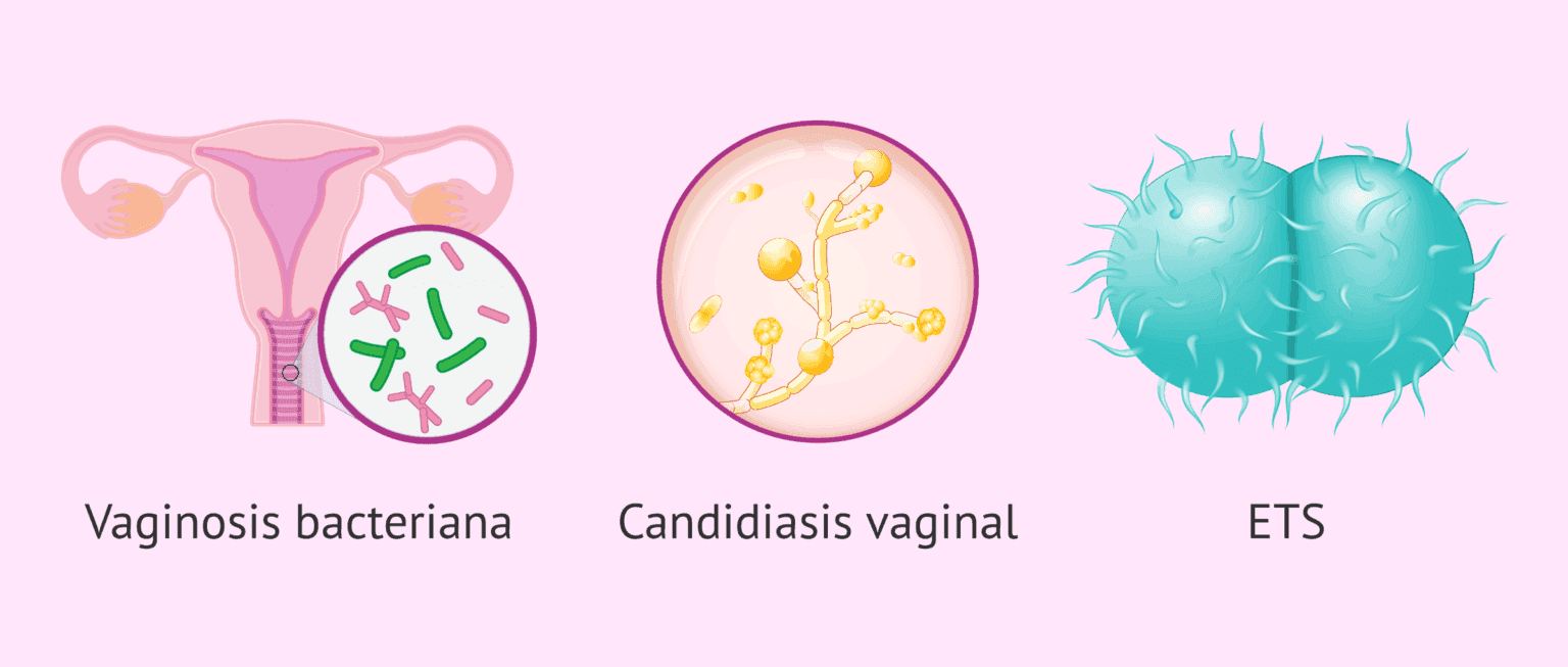 ¿A qué se deben los cambios en el flujo vaginal?