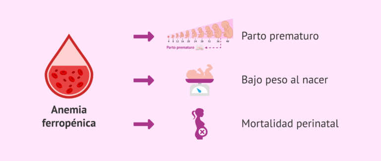 Riesgos de la anemia durante el embarazo