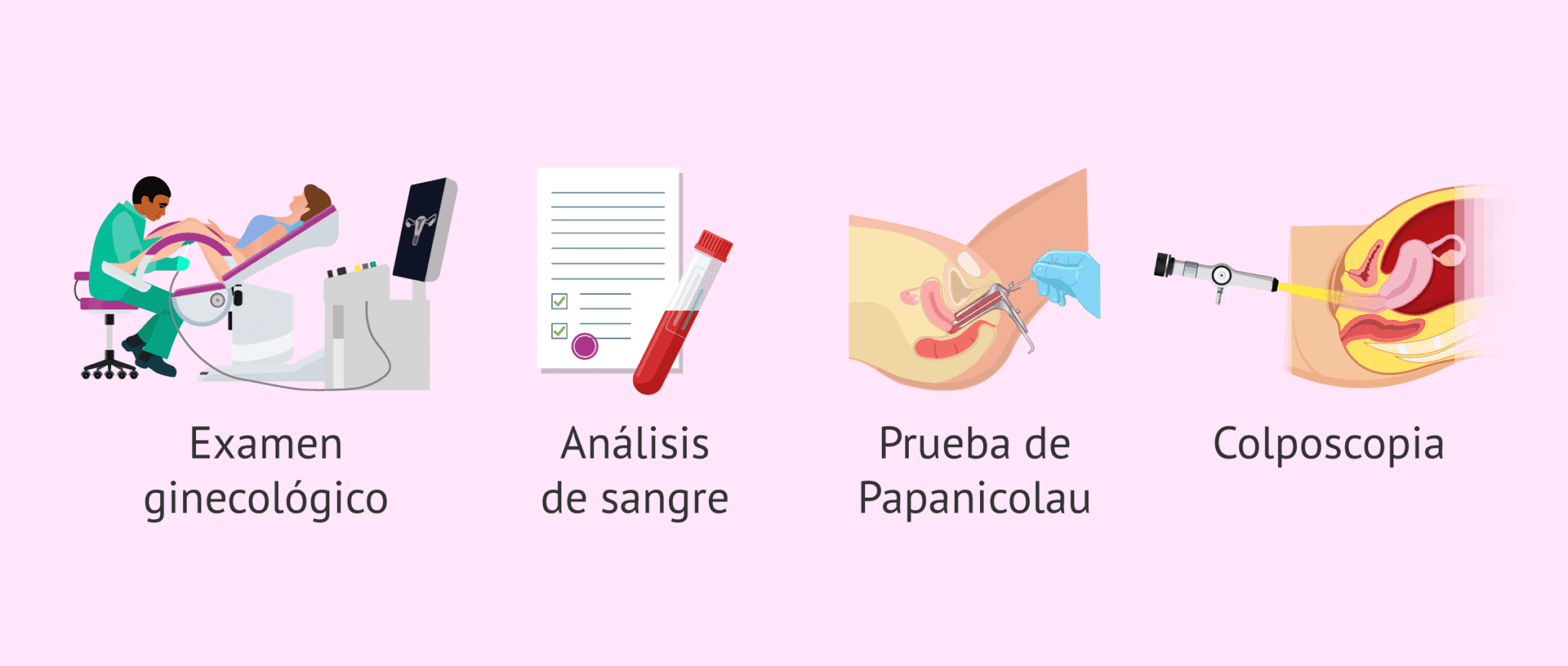 ¿Cómo es la menstruación irregular y cuáles son sus causas?