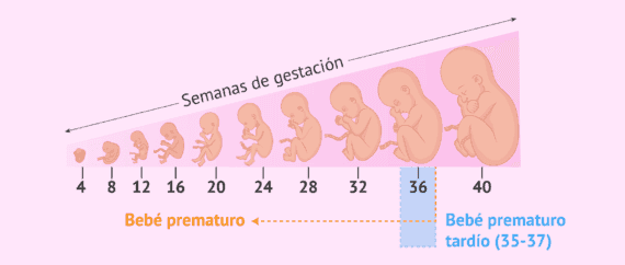 ¿Cuándo se considera un bebé prematuro?