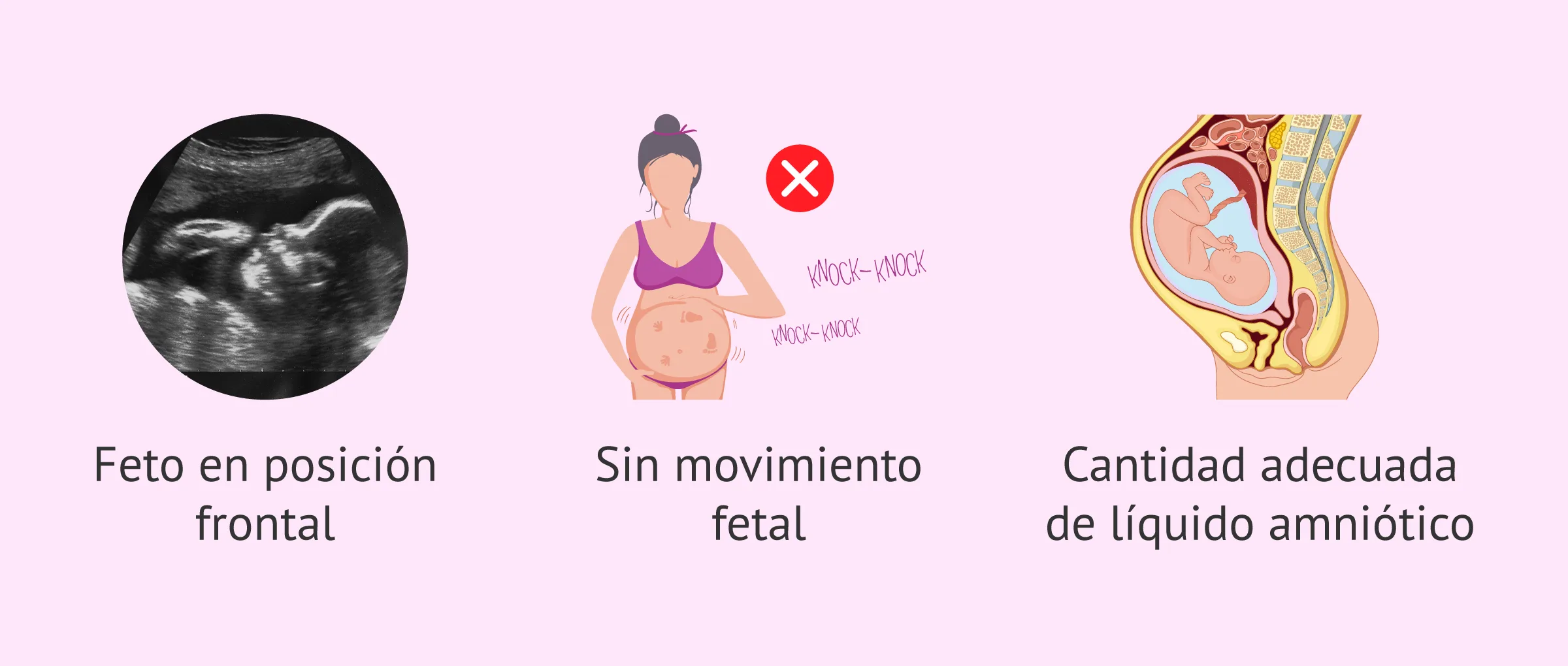 Ecografía 3d De Feto De 24 Semanas Won Inaccesible Sesión Plenaria