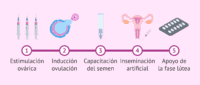 ¿Cuáles son los requisitos para la inseminación artificial intrauterina?