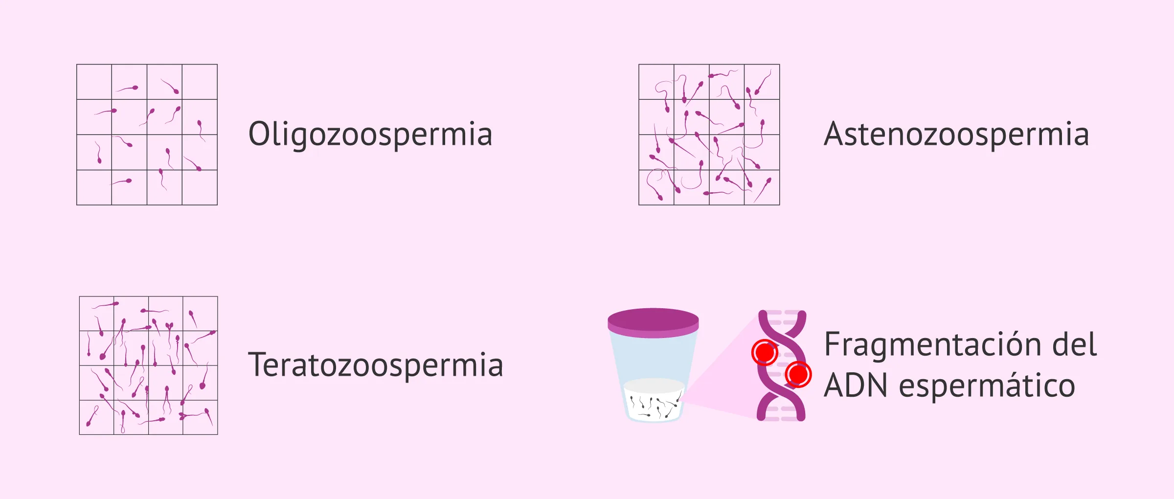 Diapositiva De Espermatozoides Humanos
