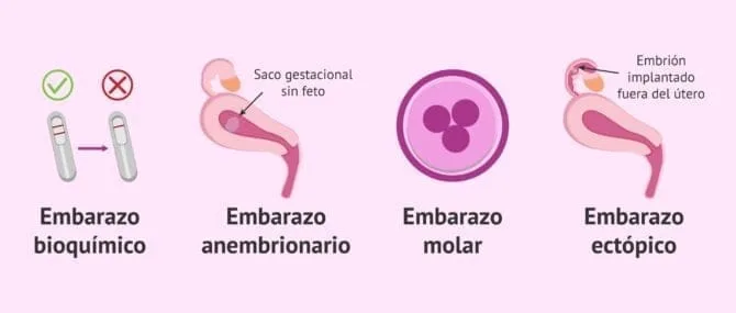 Las Etapas Del Embarazo El Embarazo Reproduccin Humana