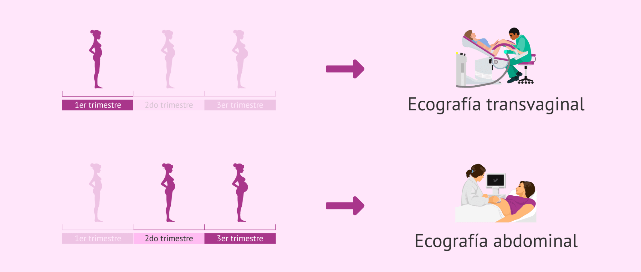 Tipo de ecografía según el momento de embarazo