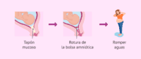 ¿Qué es romper aguas durante el embarazo?¿Es una señal de parto?