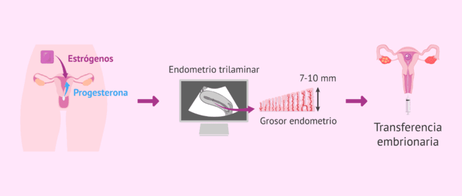 Proceso para la preparación del endometrio antes de la transferencia
