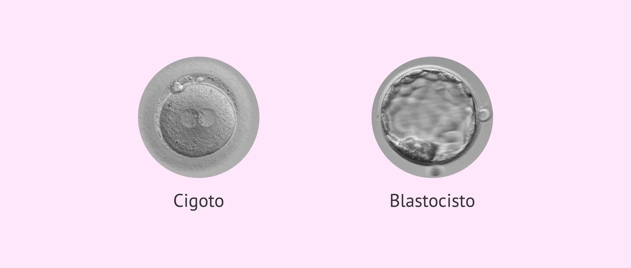Diagrama Del Cigoto Humano