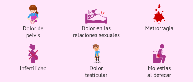 Síntomas de algunos teratomas