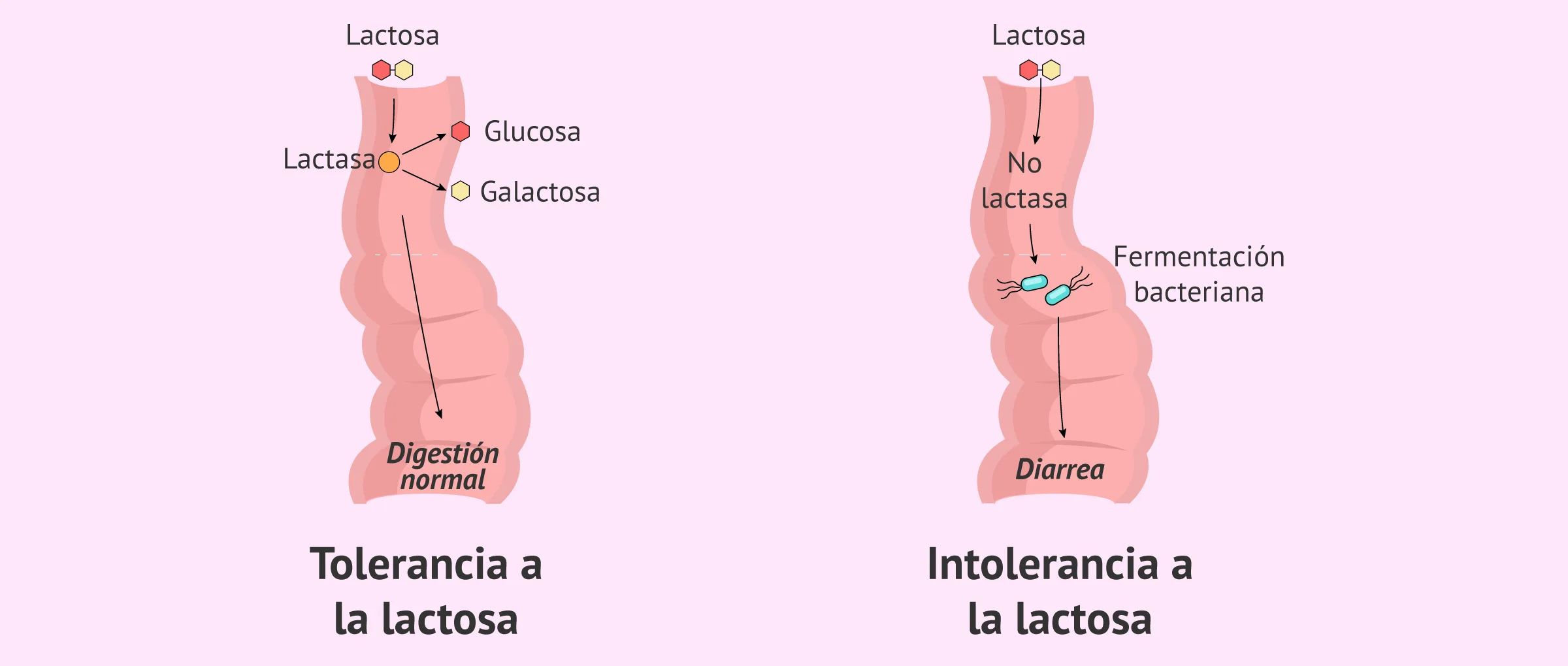 Intolerancia Concepto Caractersticas Tipos Y Ejemplos